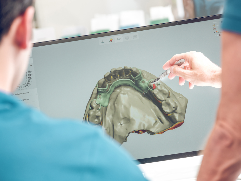 Why Digital Smile Design is the Future of Smile Makeovers